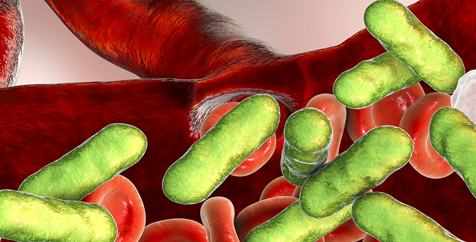 Sepsis: testing before starting treatment is essential | McGill ...