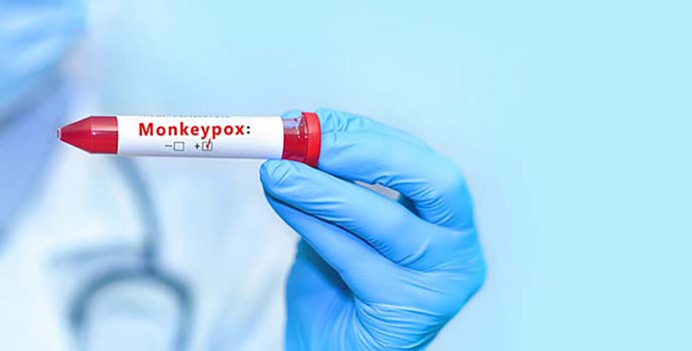 A first large detailed description of the worldwide 2022 monkeypox ...