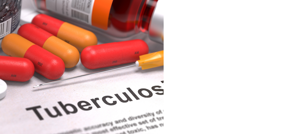 New Global TB Dictionary aims to standardize terminology in ...