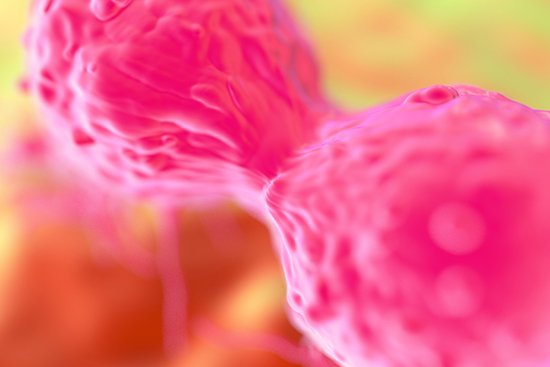 Searching for the “signature” causes of BRCAness in breast cancer ...
